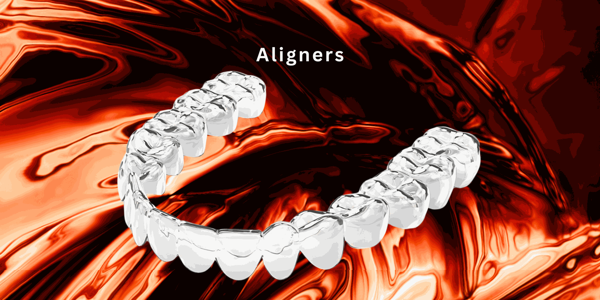 Aligners - Clear Aligners